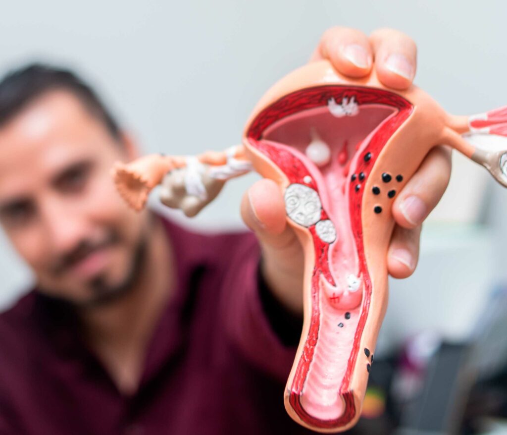 Conización Cervical y LEEP